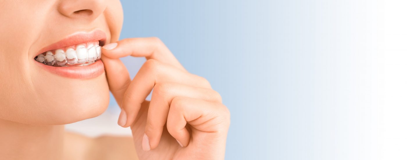 Orthodontics & Invisalign | Braces in Narre Warren & Doncaster